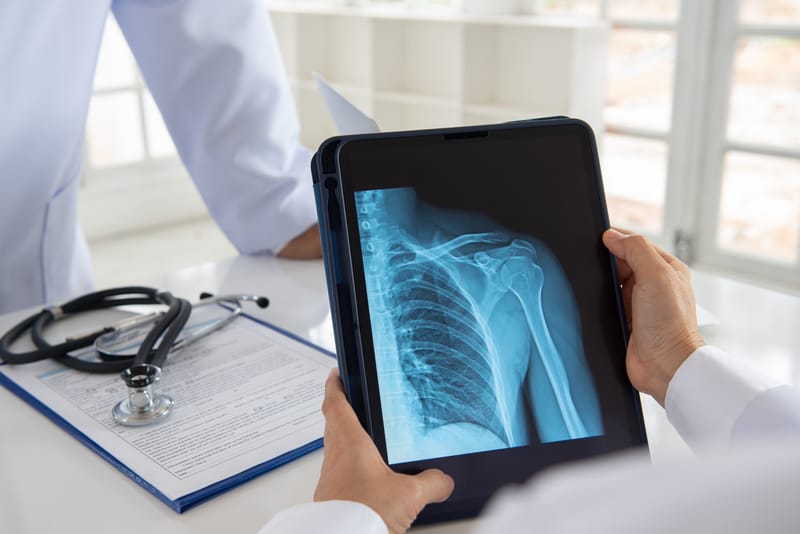 causes-of-musculoskeletal-pain-across-organ-systems-medicinelk