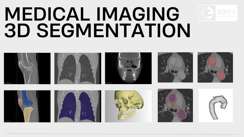 Data annotation Services | Data labelling | Medical annotation