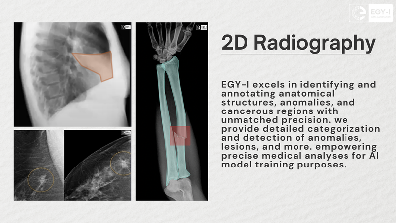 Medical annotation services | Chest x- ray segmentation | Diagnosis AI