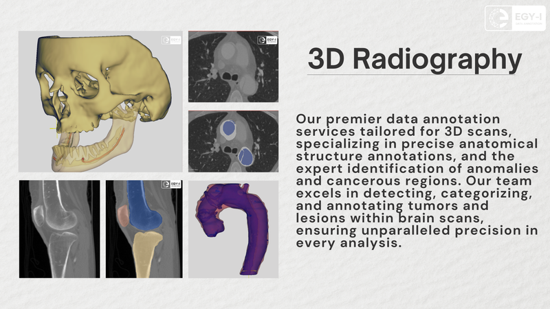 AI's Vital Role in Advancing CT and MRI Diagnoses
