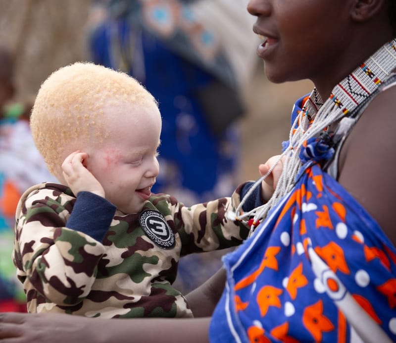 What UVSafe OFFERS. - Black Albinism