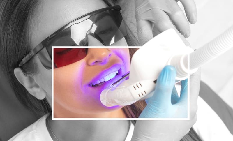 Teeth Whitening in Dubai - Achieve a Brighter Smile!